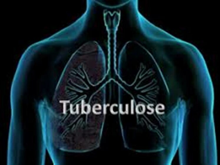 OMS alerta para o risco de descontrole da tuberculose | CRF-AL